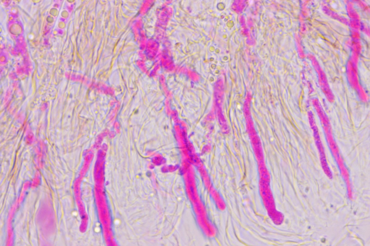 Cylindrobasidium evolvens | CrustFungi.Com